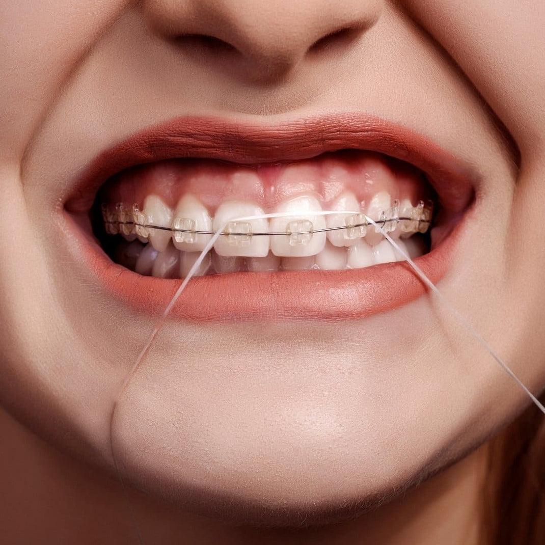 Flosii™ Water Flosser – Plaque-Free Smile in 2 Minutes | Gentle & Effective